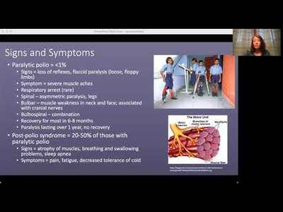 Polio Presentation - BYU-Idaho