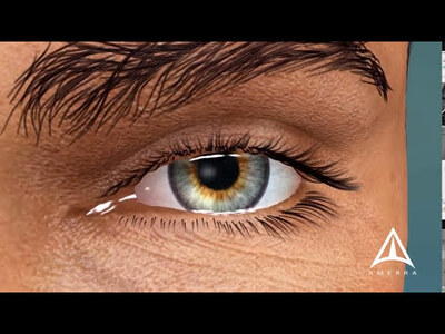 Macular Degeneration - vision disease - 3D animation - BYU-Idaho