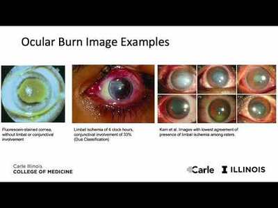 Team 01: A Novel Approach to Automated Ocular Burn Image Classification ...
