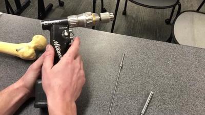 SCFE Screw Removal with Coring Reamer - POSNAcademy