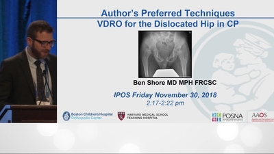 VDRO for the Dislocated Hip in Cerebral Palsy - POSNAcademy