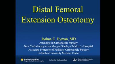 Distal Femoral Extension Osteotomy - POSNAcademy