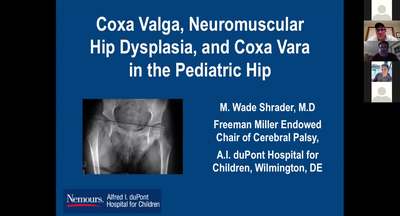 Coxa Valga, Neuromuscular Hip Dysplasia and Coxa Vara in the Pediatric ...