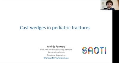 10. Cast Wedges in Pediatric Fractures - POSNAcademy