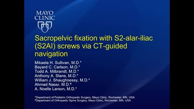 Sacropelvic fixation with S2-alar-iliac (S2AI) screws via CT-guided ...