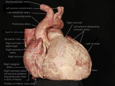 Heart: horizontal rotation - The University of Sheffield Kaltura ...