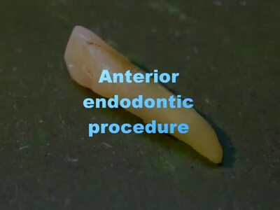 Complete RCT procedure - The University of Sheffield Kaltura Digital ...