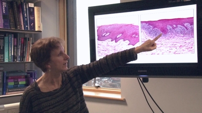 The Role of the Oral Pathologist - The University of Sheffield Kaltura ...