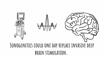 Progress for Sonogenetics a non-invasive way to treat brain disorders ...
