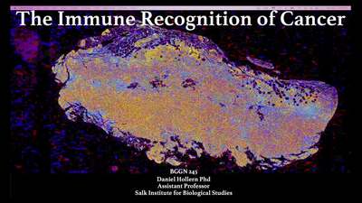 Dan Hollern - Information processing and anti-tumor immune responses ...