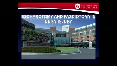 12/15/16 The role of escharotomy and fasciotomy in the burned patient ...